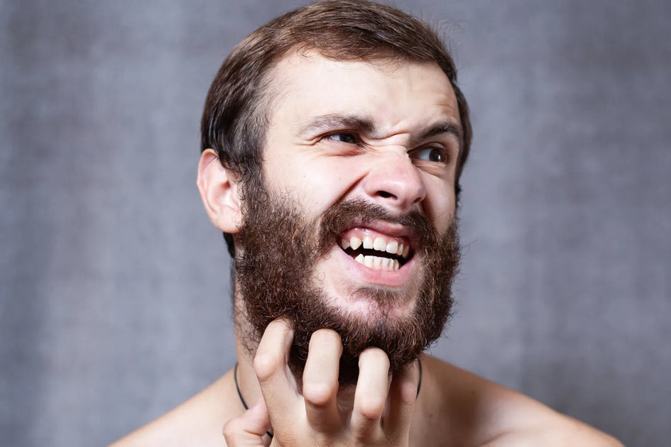 Beard Burn: What Is It, Causes, and How To Prevent – The Beard Club