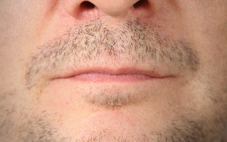 How To Fix Patchy Beard: 7 Ways To Improve Uneven Beard Growth – The ...
